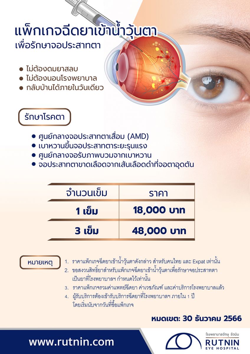 แพ็กเกจฉีดยาเข้าน้ำวุ้นตา